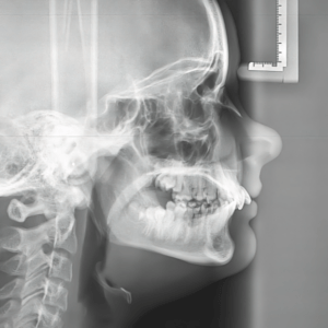 Telerradiografia Digital - Uniero