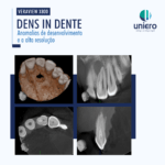 DENS IN DENTE - Uniero