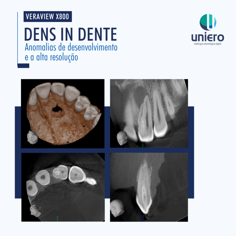 DENS IN DENTE - Uniero