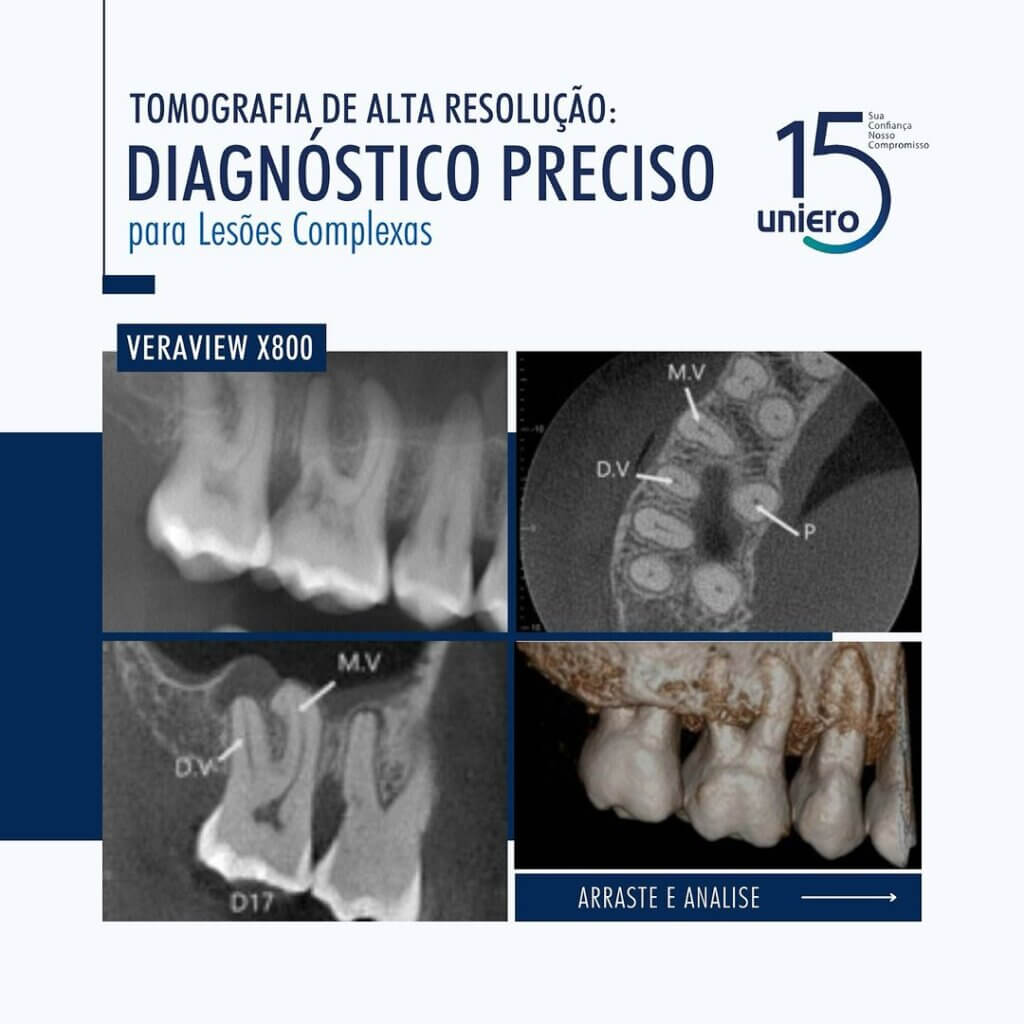 DENS IN DENTE - Uniero